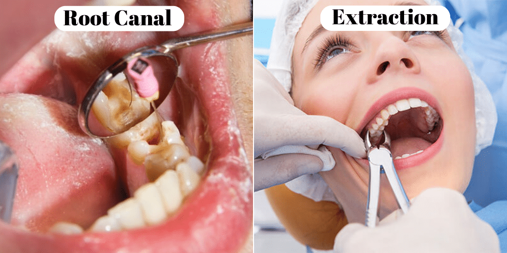 What Does The Inside Of A Tooth Extraction Look Like Infoupdate What Does The Inside Of A Tooth Extraction Look Like Infoupdate