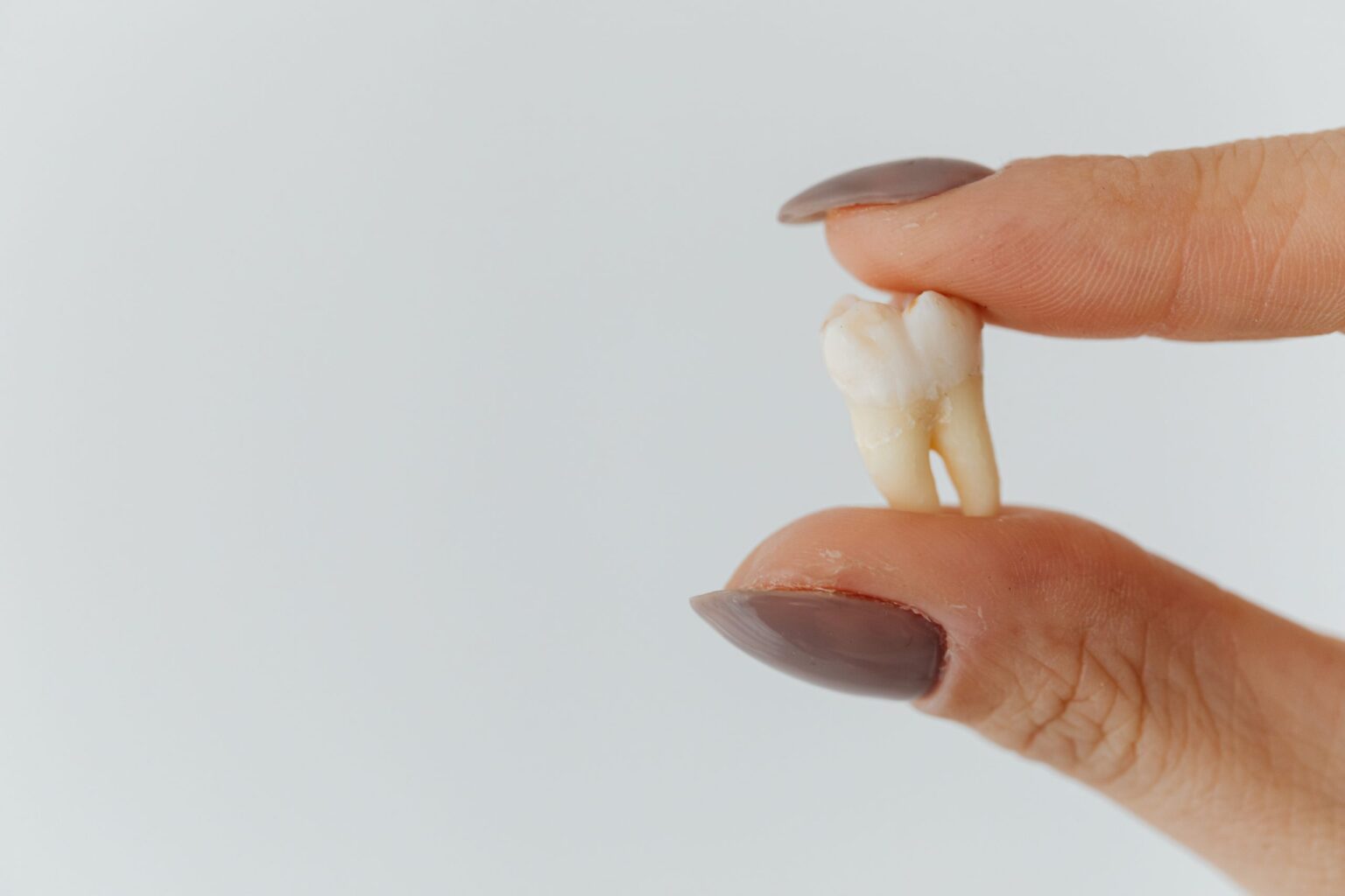 Easy Home Methods to Remove a Loose Tooth: A Complete Guide