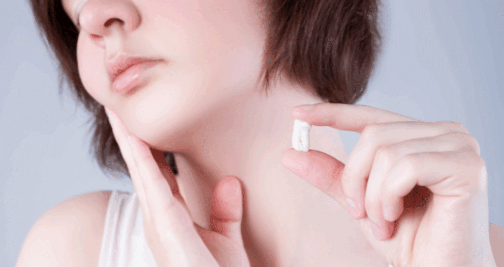 What Happens to Stitches After Wisdom Tooth Removal? Learn Here