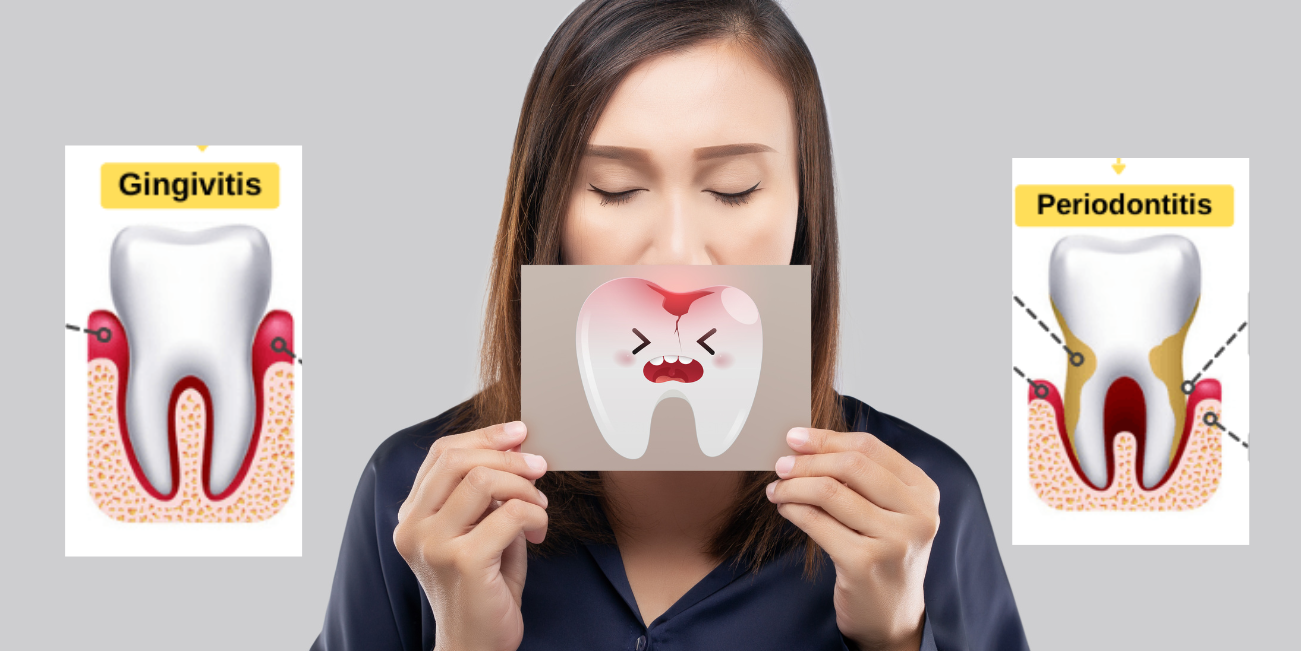What Is The Best Antibiotic For Gum Infection?